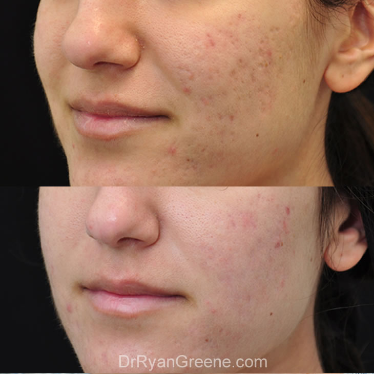 Before and After Gallery | Greene.MD